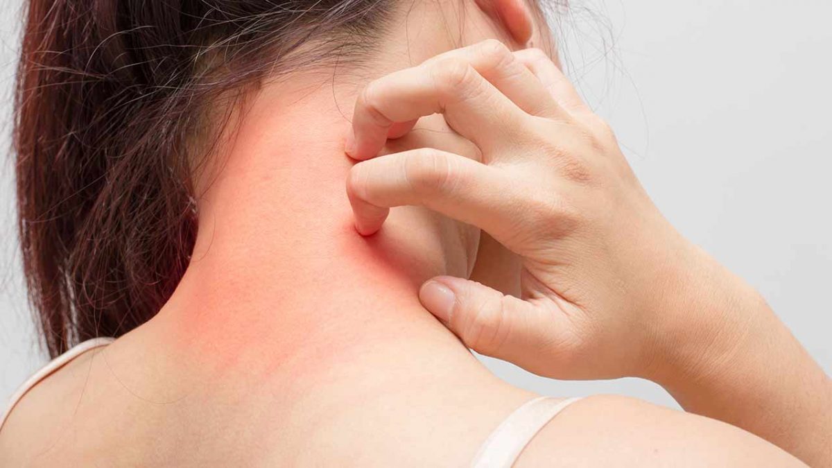 Los tipos de infecciones en la piel más comunes - Dermipedia